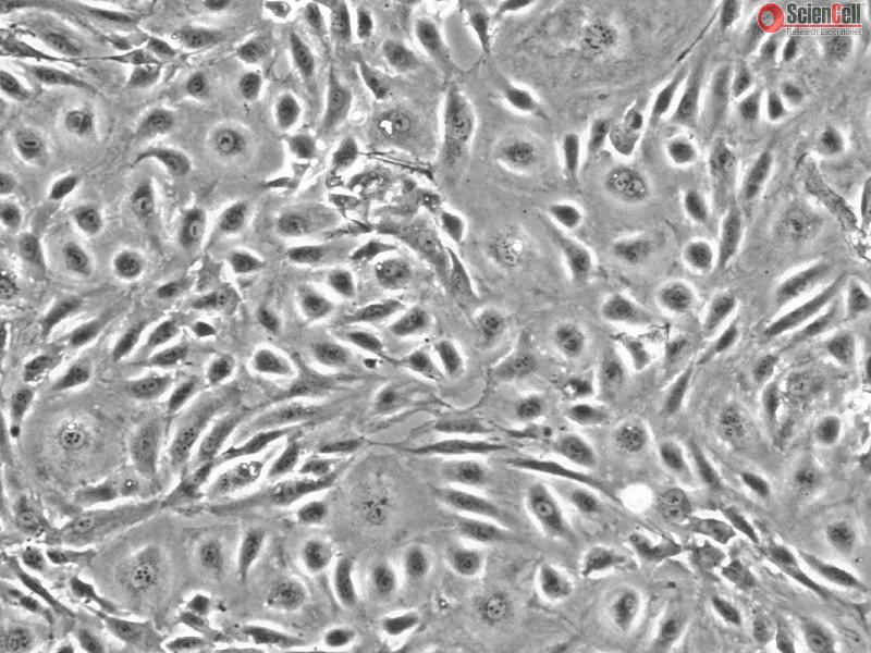 Human Coronary Artery Endothelial Cells