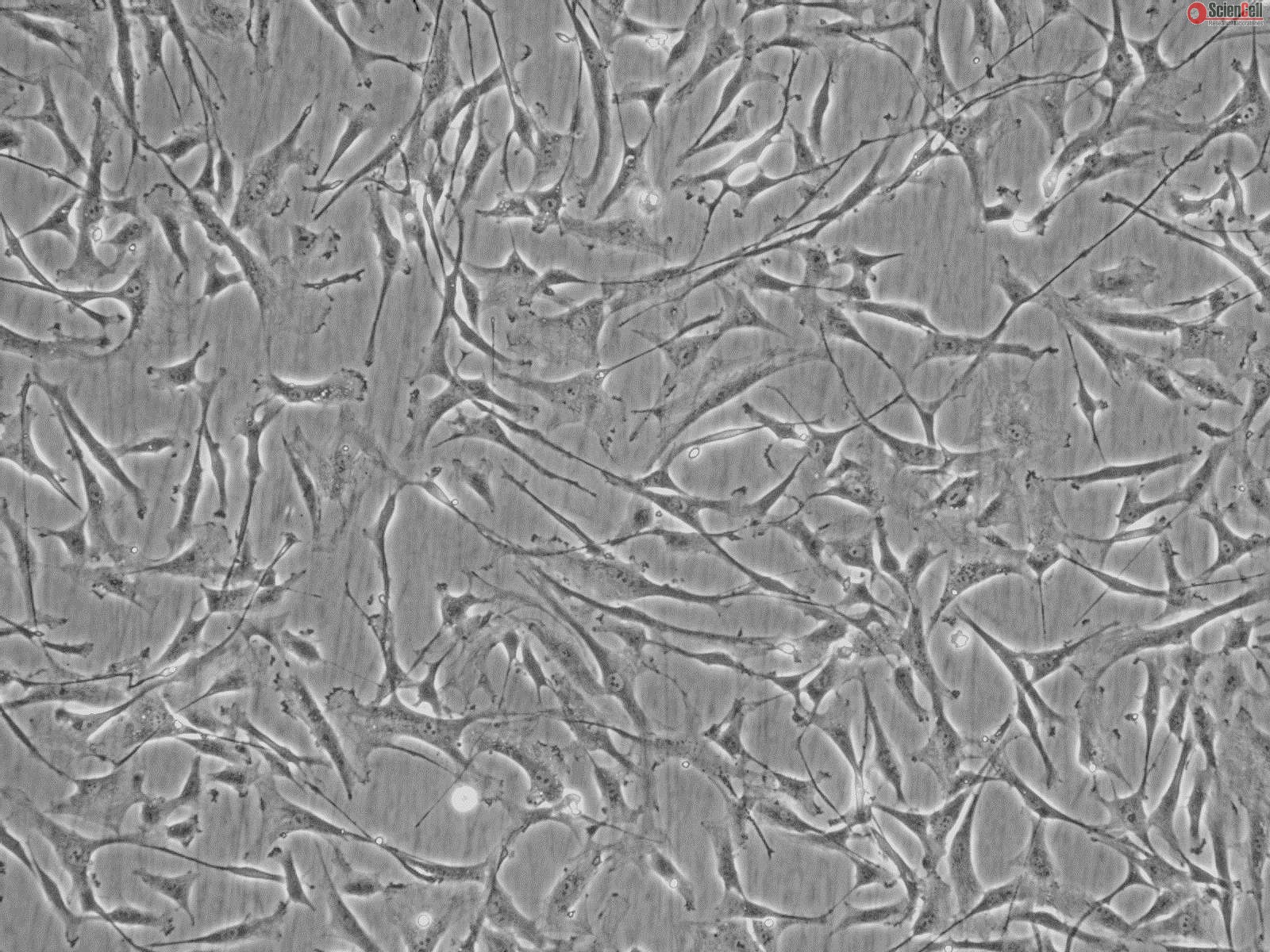 Human Aortic Smooth Muscle Cells, HASMC