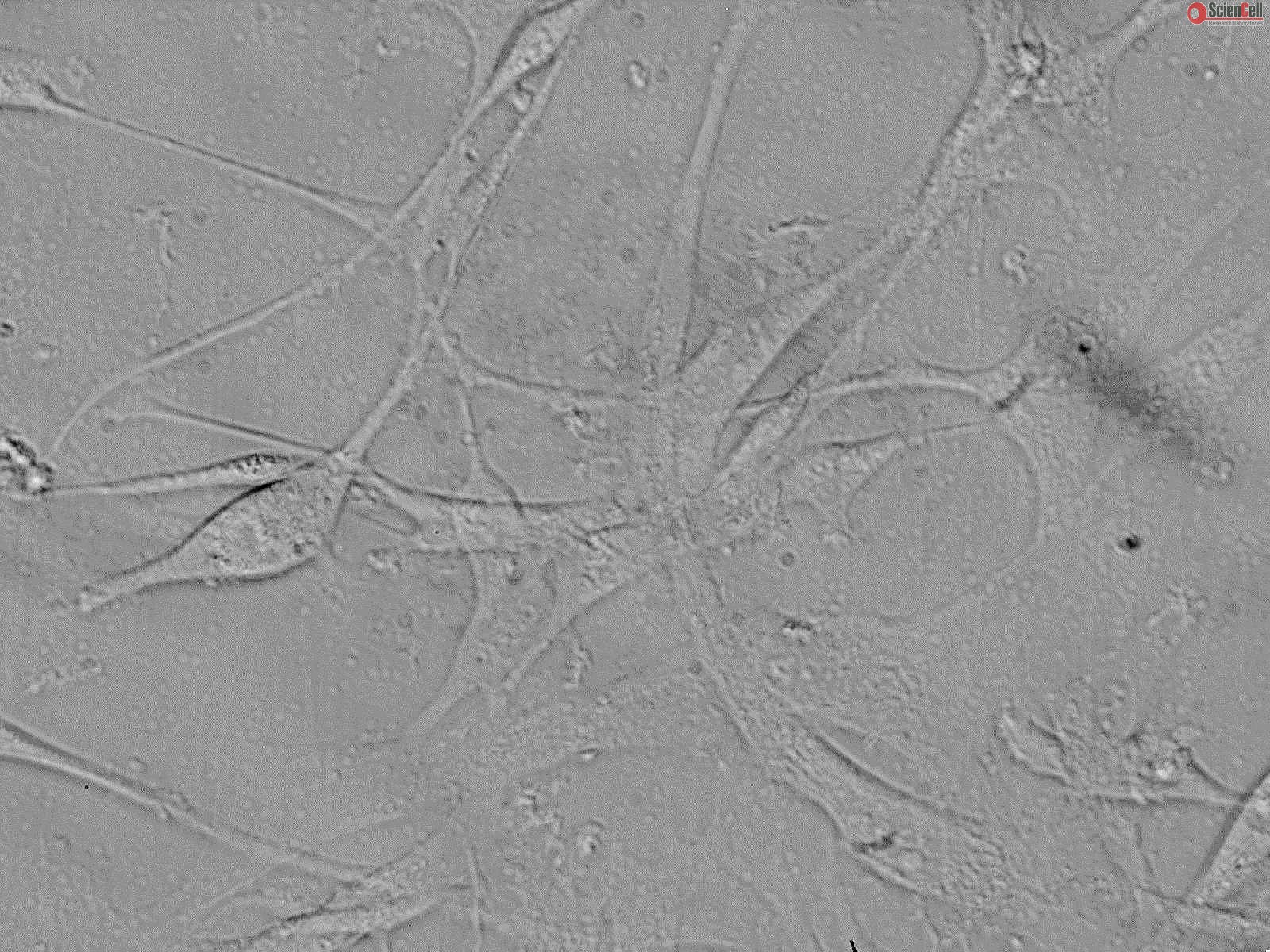 Human Aortic Smooth Muscle Cells, HASMC