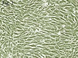 Human Aortic Smooth Muscle Cells, HASMC