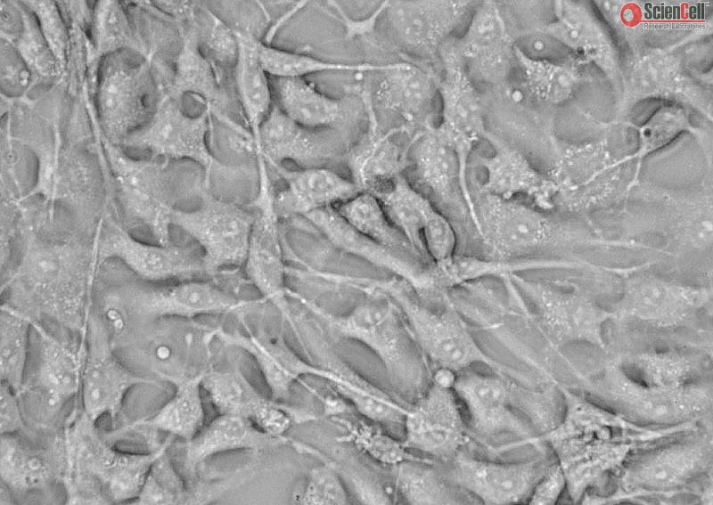 Human Cardiac Myocytes, HCM
