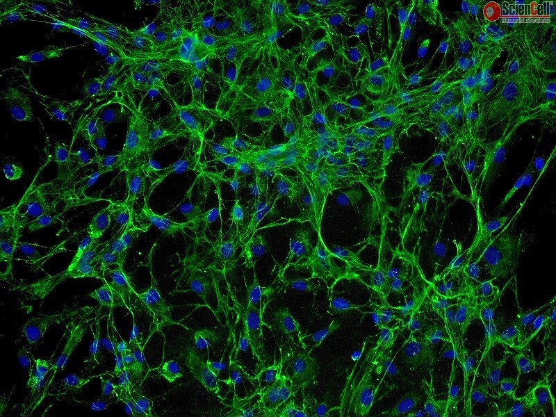 Human Cardiac Fibroblasts, HCF