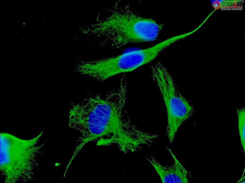 Human Cardiac Fibroblasts, HCF