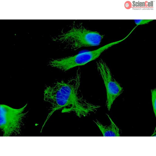 Human Cardiac Fibroblasts, HCF