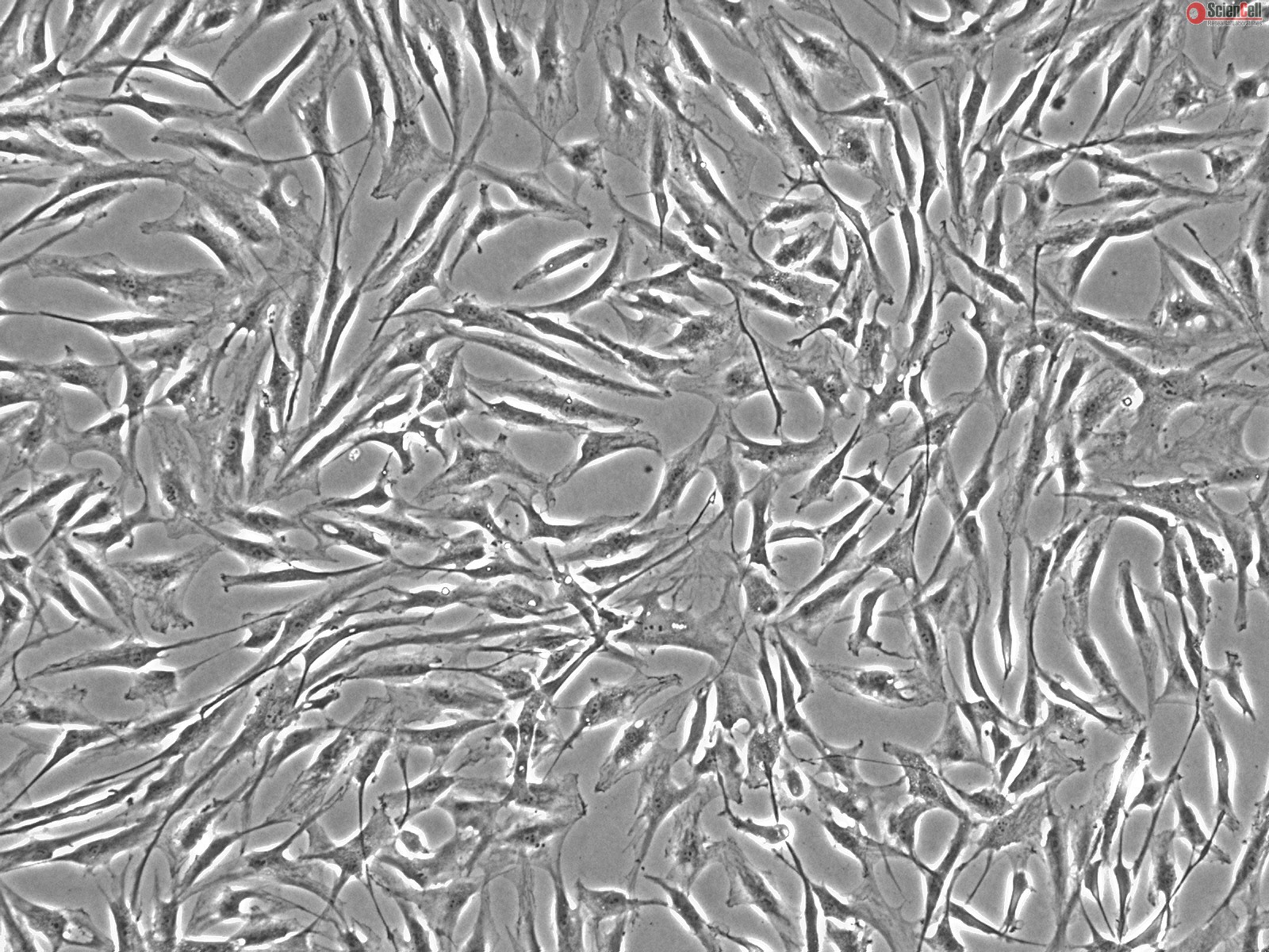 Human Cardiac Fibroblasts - adult ventrical, HCF-av