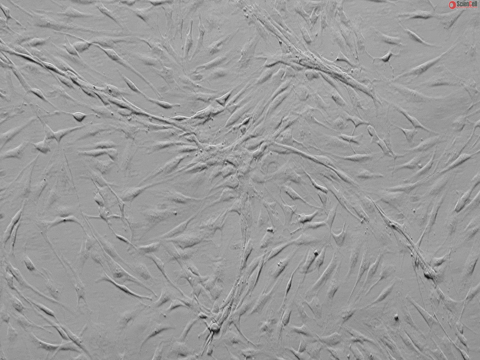 Human Cardiac Fibroblasts - adult ventrical, HCF-av