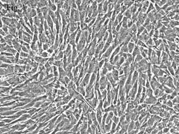 Human Cardiac Fibroblasts-adult atrial, HCF-aa