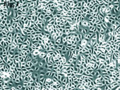 Human Corneal Epithelial Cells, HCEpiC