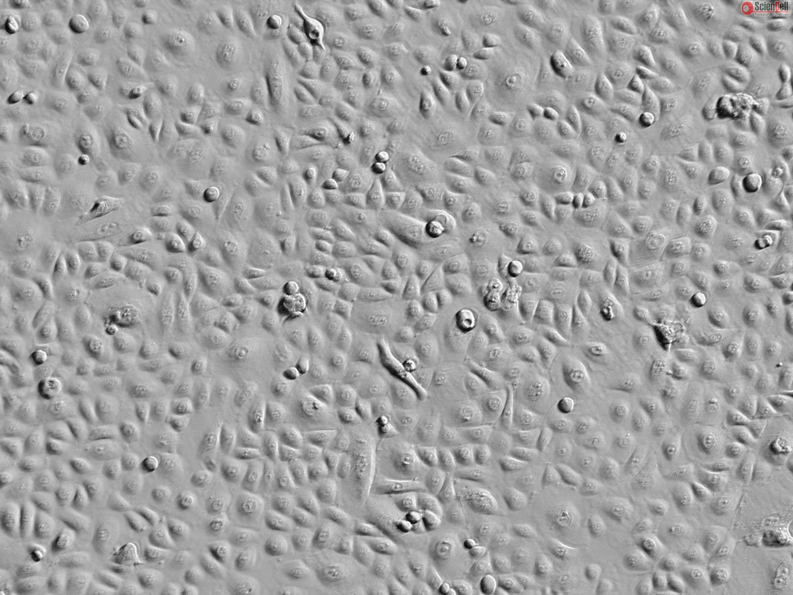 Human Corneal Epithelial Cells, HCEpiC