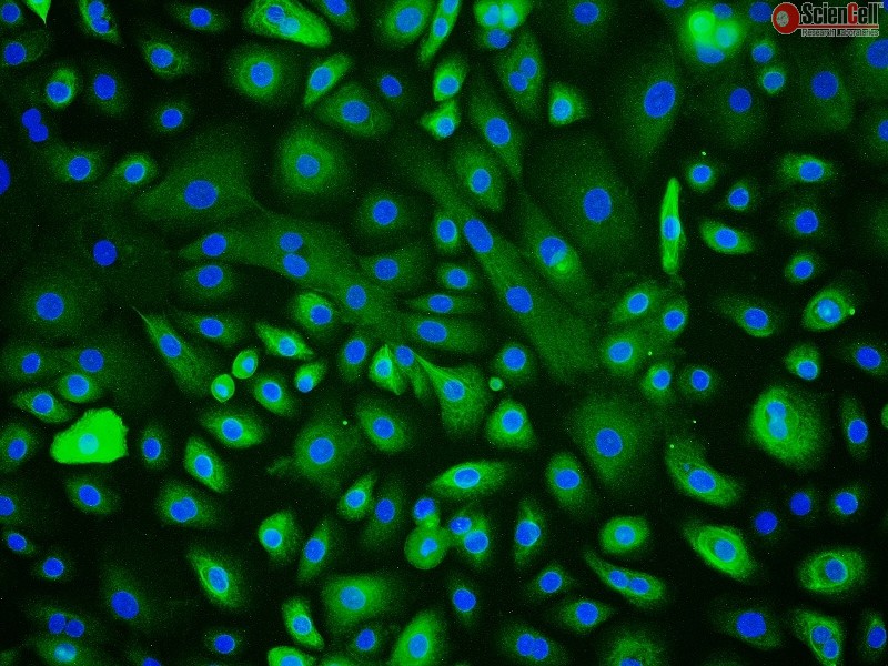 Human Corneal Epithelial Cells, HCEpiC