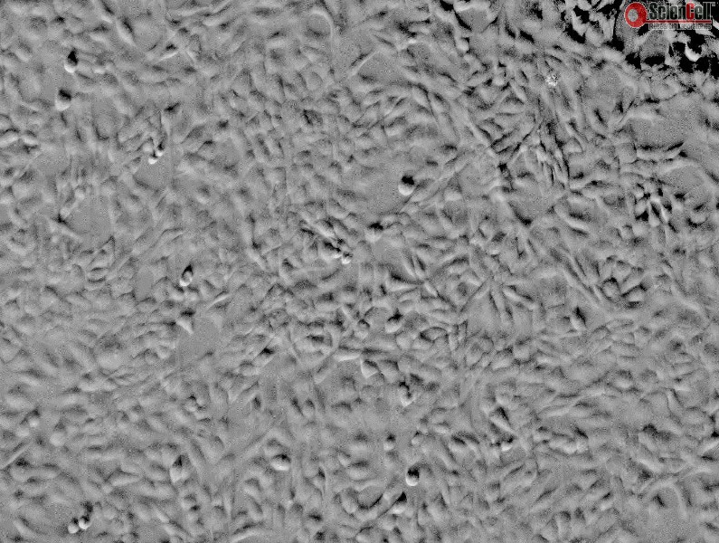 Human Retinal Pigment Epithelial Cells, HRPEpiC