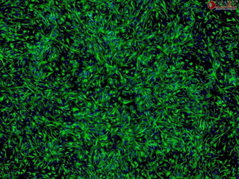 Human Retinal Pigment Epithelial Cells, HRPEpiC