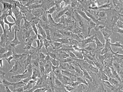 Human Lens Epithelial Cells-adult, Passage 1