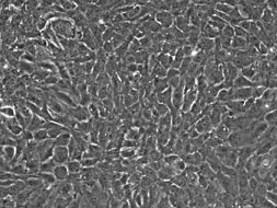 Human Iris Pigment Epithelial Cells, HIPEpiC