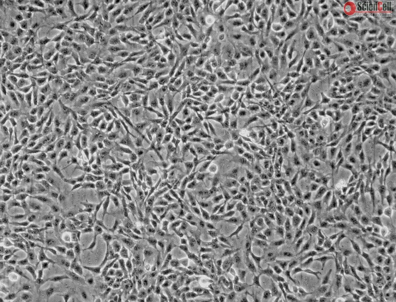 Human Iris Pigment Epithelial Cells, HIPEpiC