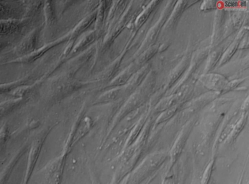 Human Myometrial Smooth Muscle Cells (HMSMC)