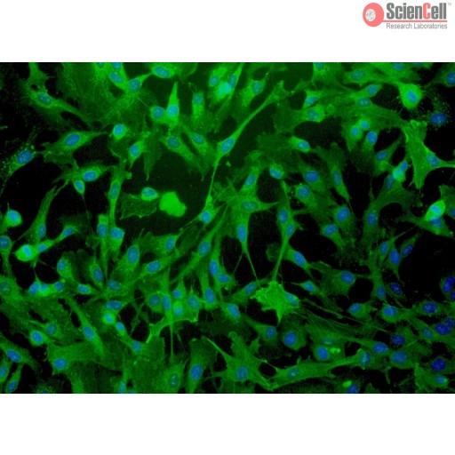 Human Myometrial Smooth Muscle Cells (HMSMC)