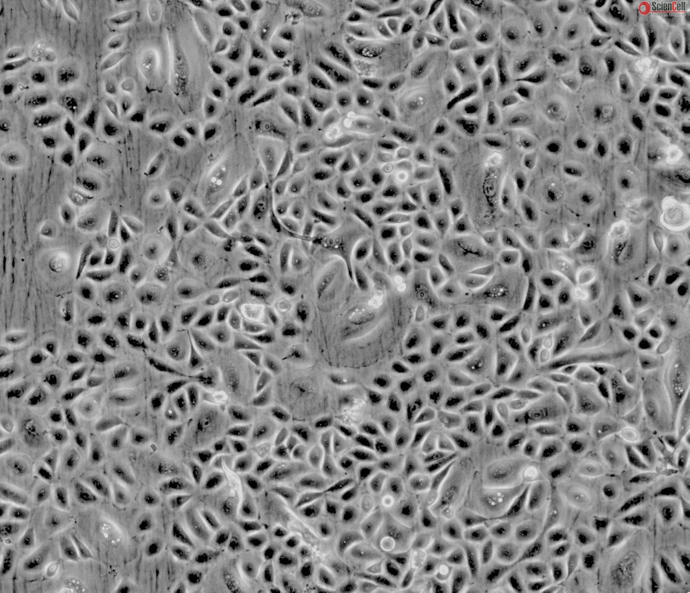 Human Ovarian Surface Epithelial Cells