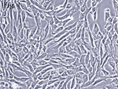 Human Mesenchymal Stem Cells-adipose, HMSC-ad