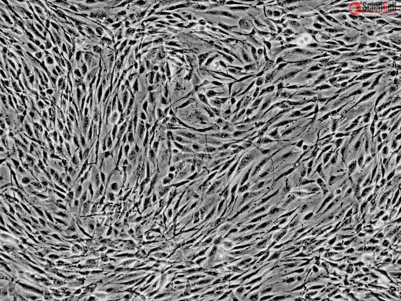 Human Mesenchymal Stem Cells-adipose, HMSC-ad