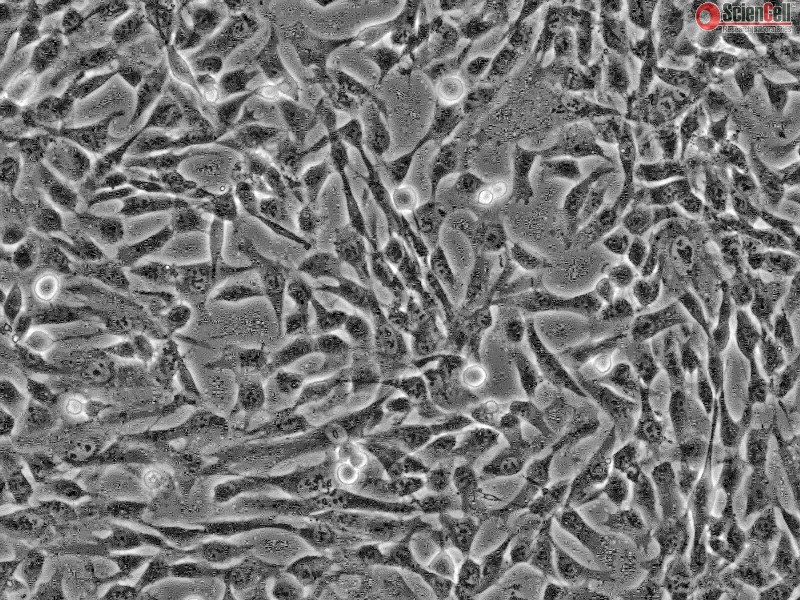 Human Umbilical Mesenchymal Stem Cells, HUMSC