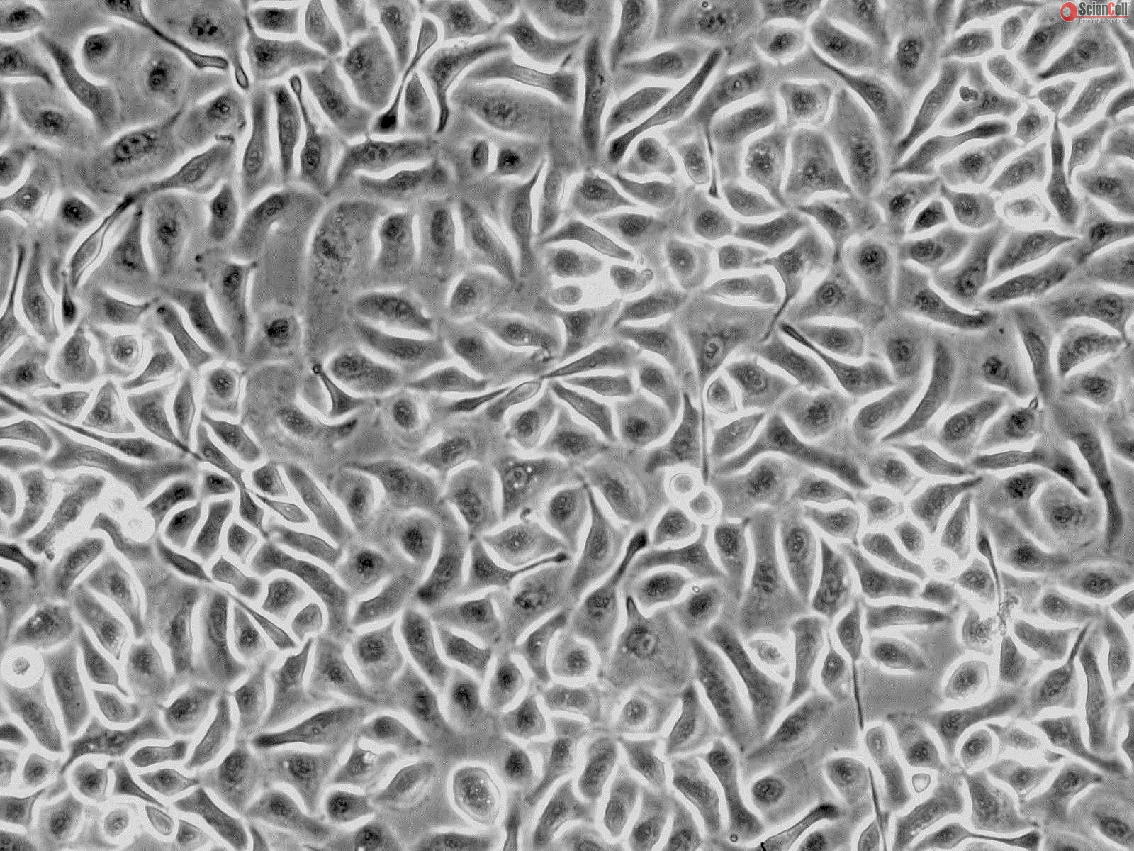 Human Mammary Epithelial Cells, HMEpiC
