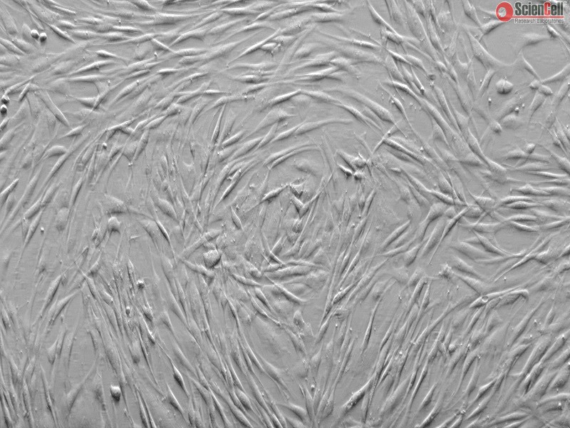 Human Mammary Fibroblasts, HMF