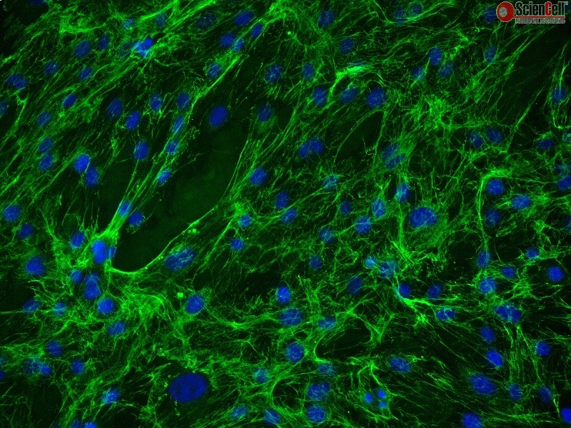 Human Mammary Fibroblasts, HMF
