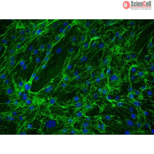 Human Mammary Fibroblasts, HMF