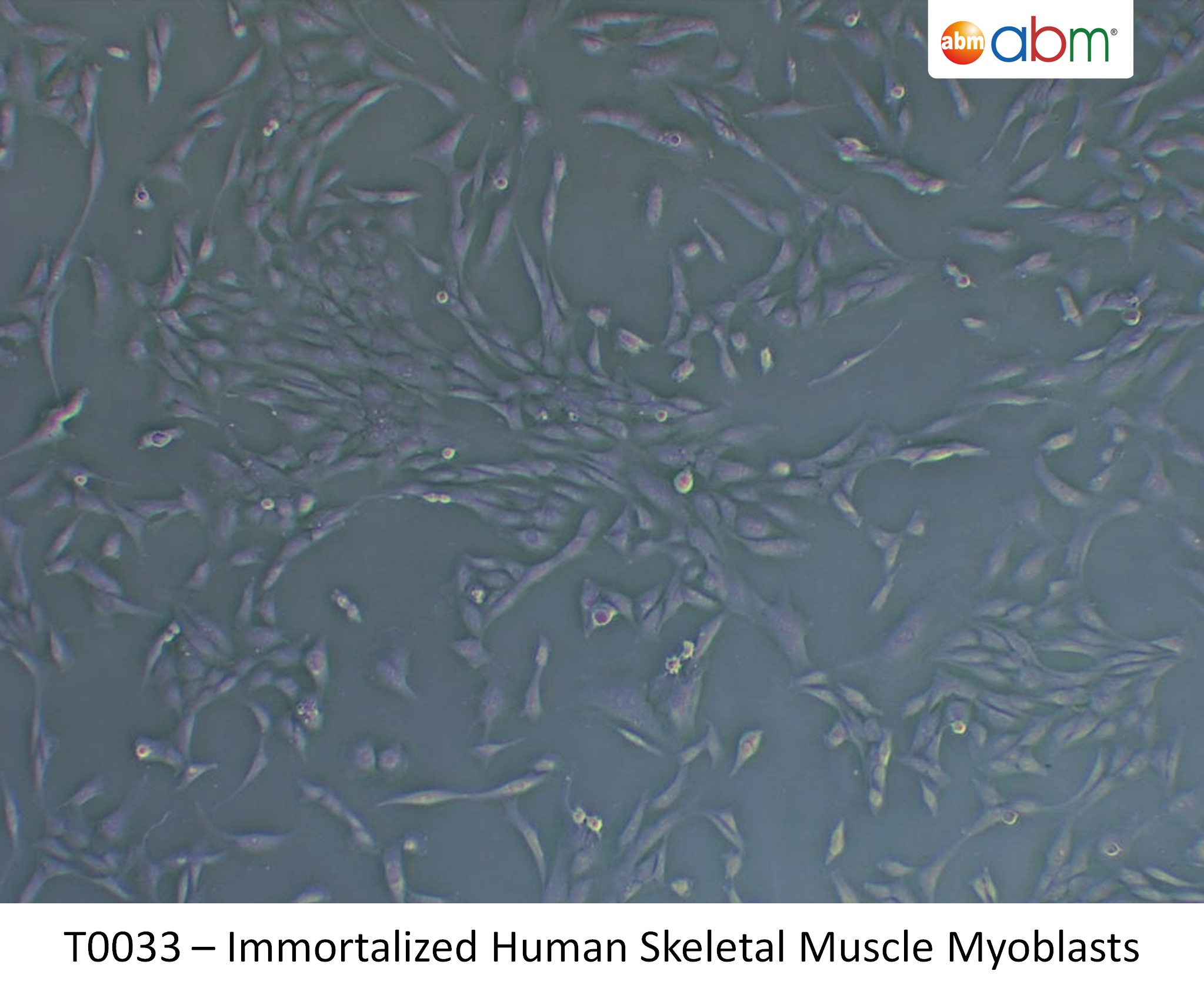 Immortalized Human Skeletal Muscle Myoblasts