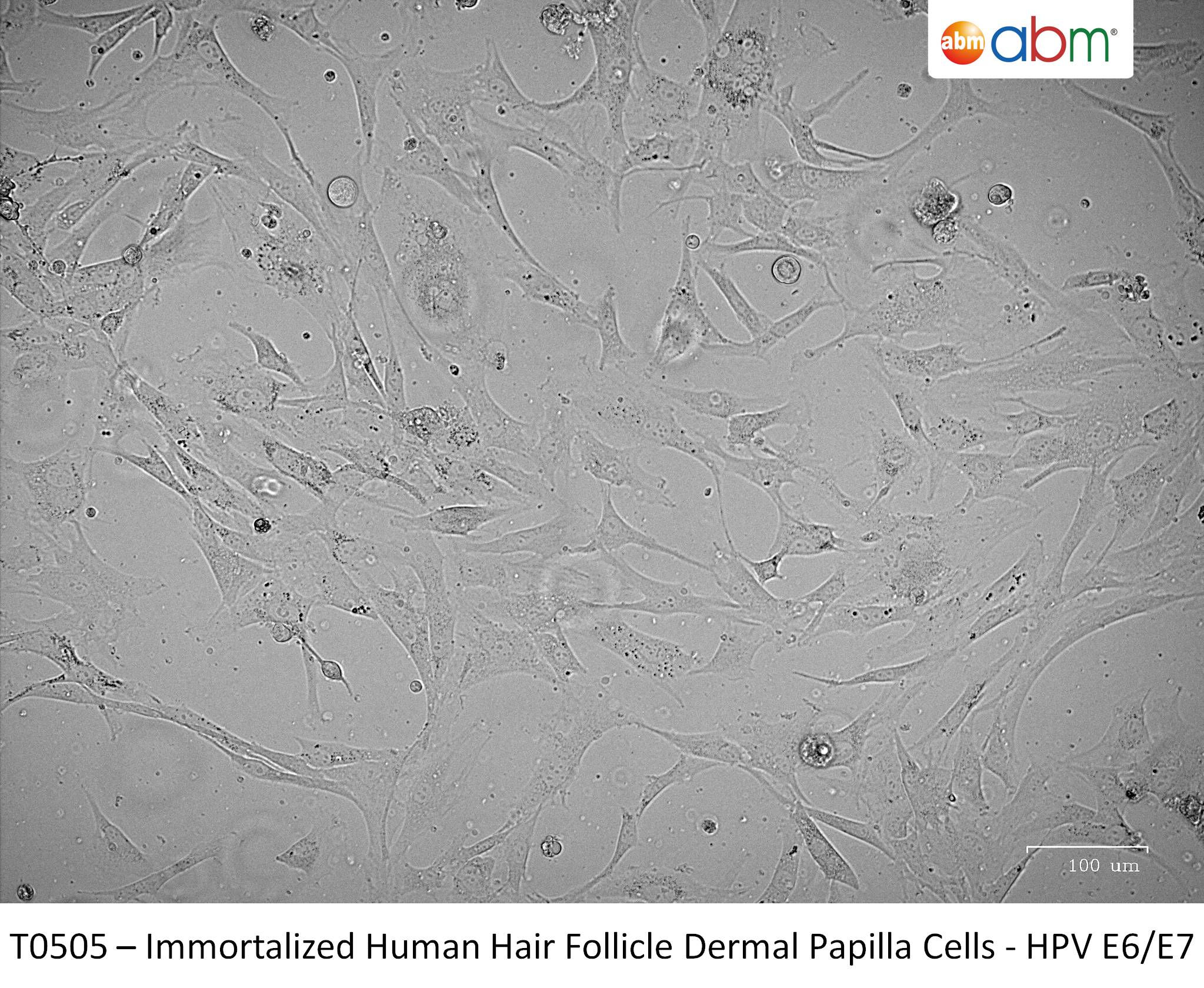 Immortalized Human Hair Follicle Dermal Papilla Cells - HPV E6/E7