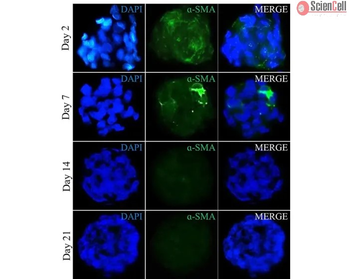 All-inclusive 3D Human Hepatic Stellate Cell Monoculture Spheroid Form