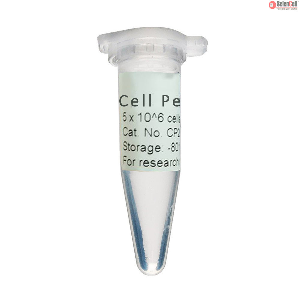 Human Choroid Plexus Endothelial Cell Pellet, 5 million primary cells