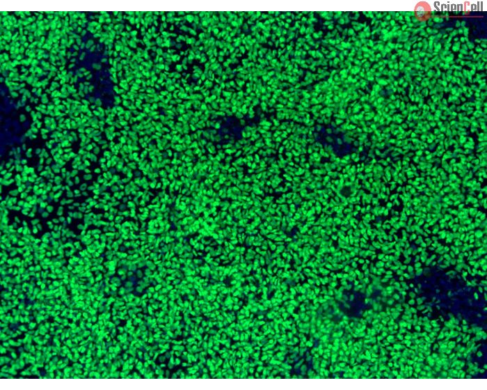 Human Pluripotent Stem Cell-derived Neural Crest Cells