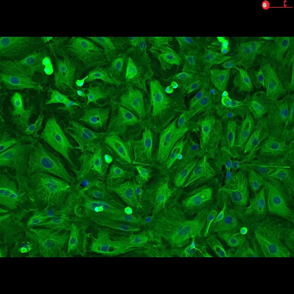 Human Pulmonary Alveolar Epithelial Cells-adult