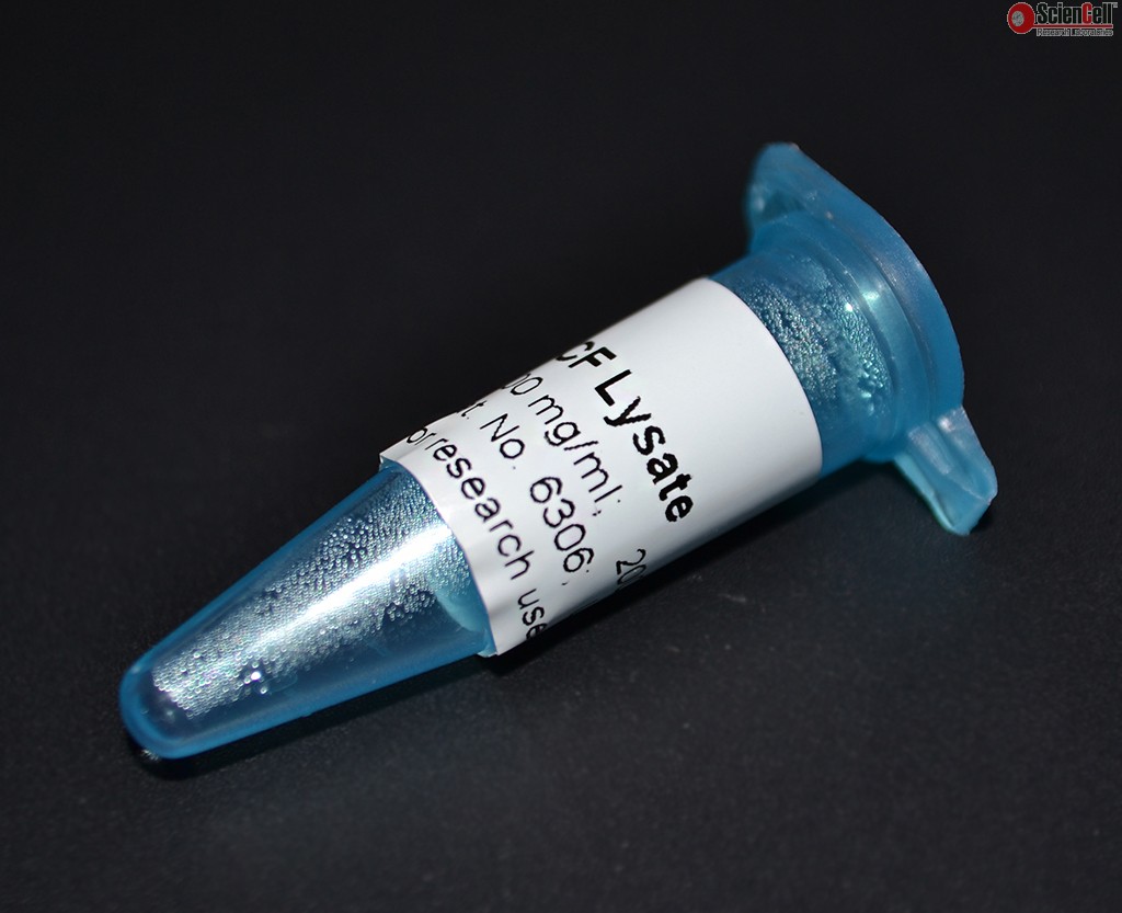 Human Epidermal Keratinocyte Lysate