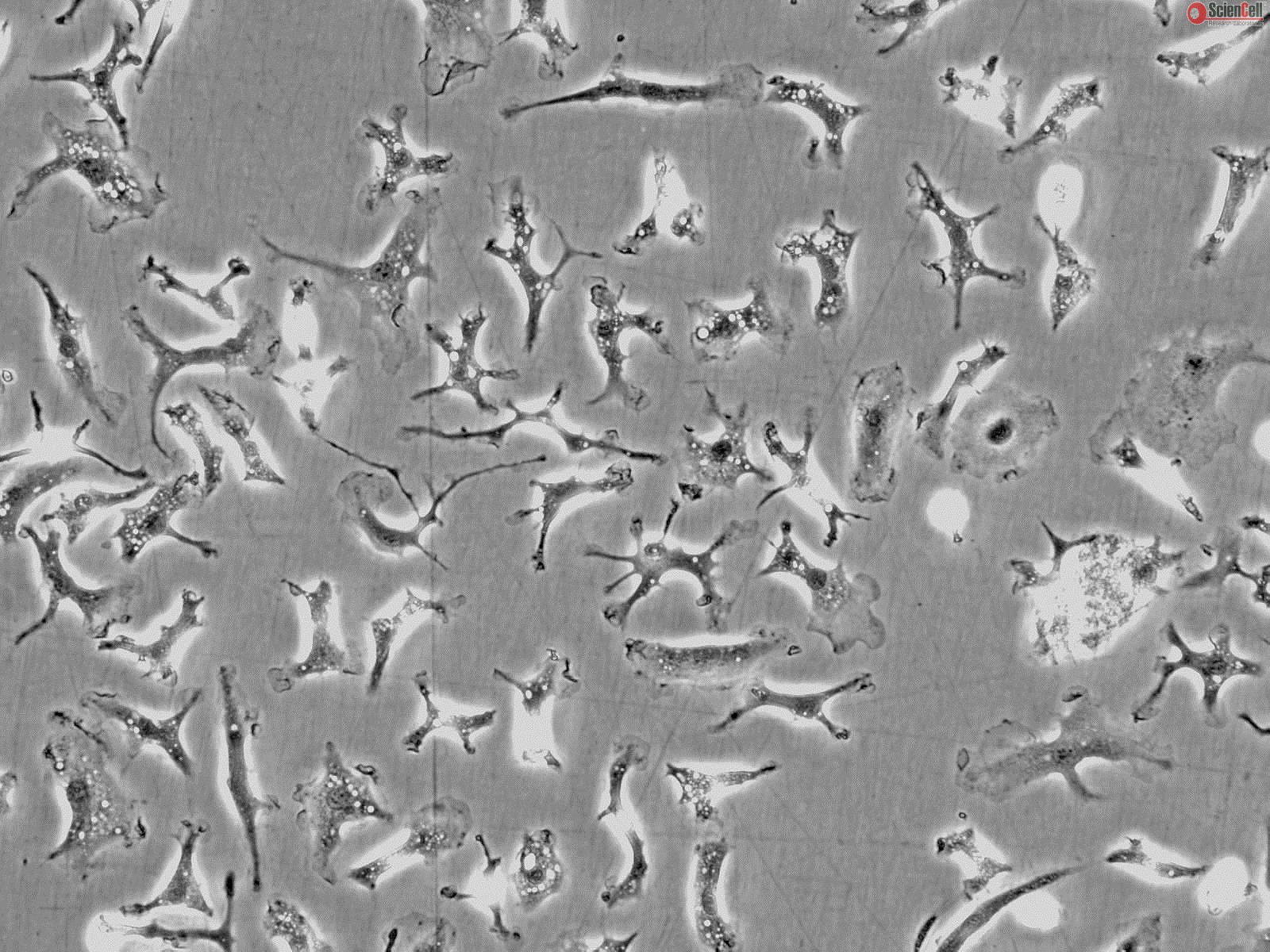 Microglial Cells Brain
