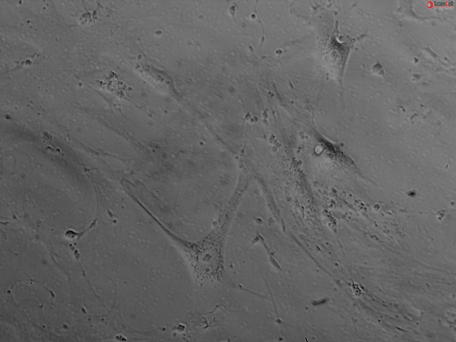 Mouse Cardiac Fibroblasts from C57BL/6