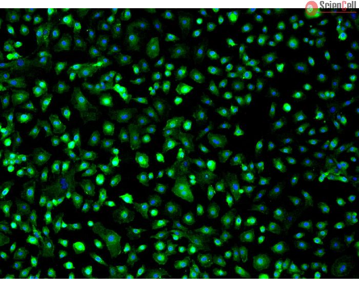 Mouse Hepatic Mesothelial Cells (MHMeC) from CD1