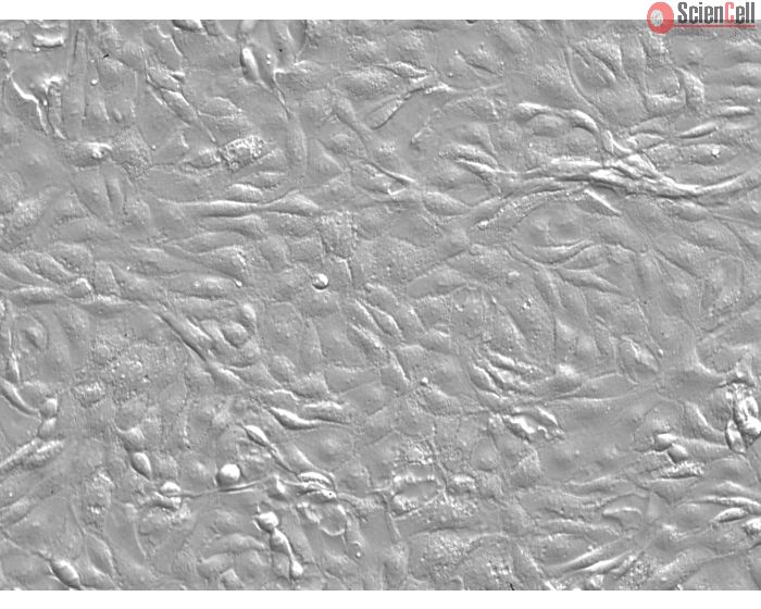Mouse Renal Proximal Tubular Epithelial Cells from CD1