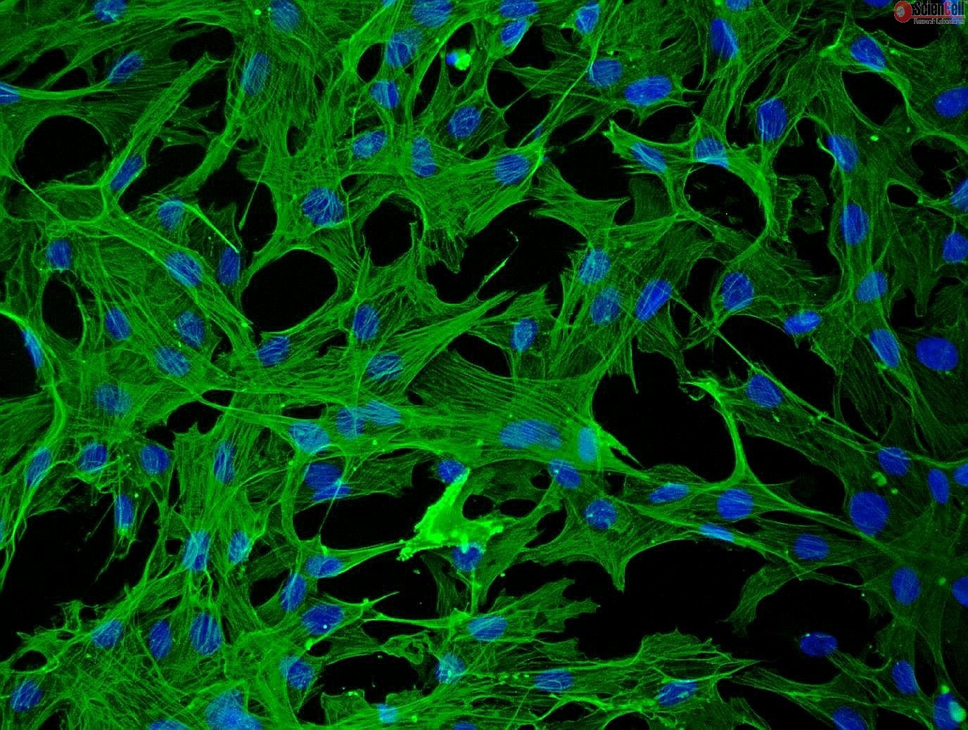 Rabbit Hepatic Stellate Cells