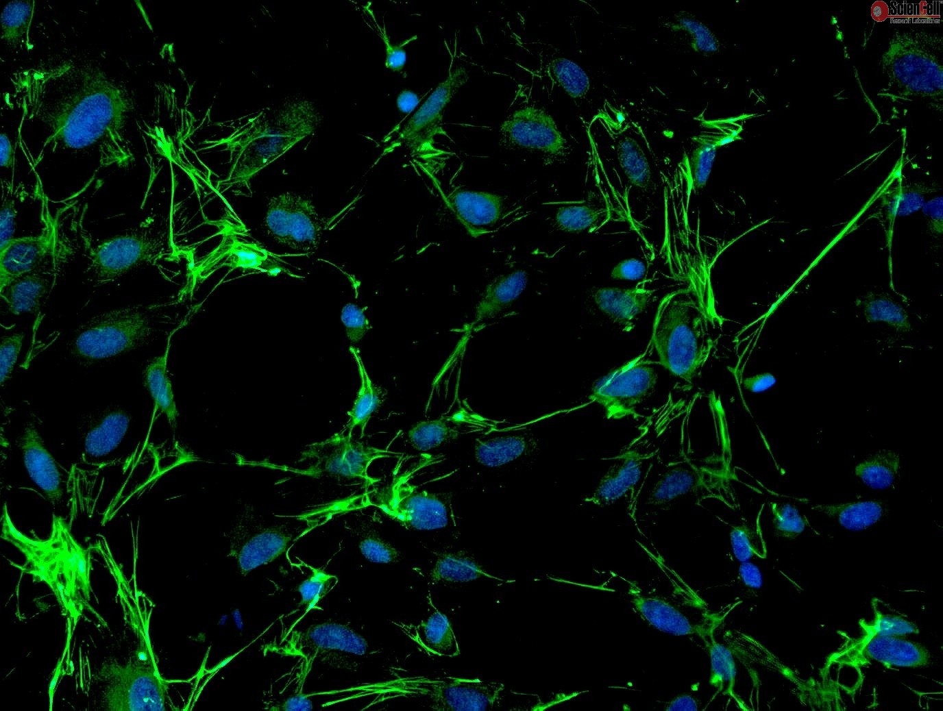 Rabbit Renal Mesangial Cells