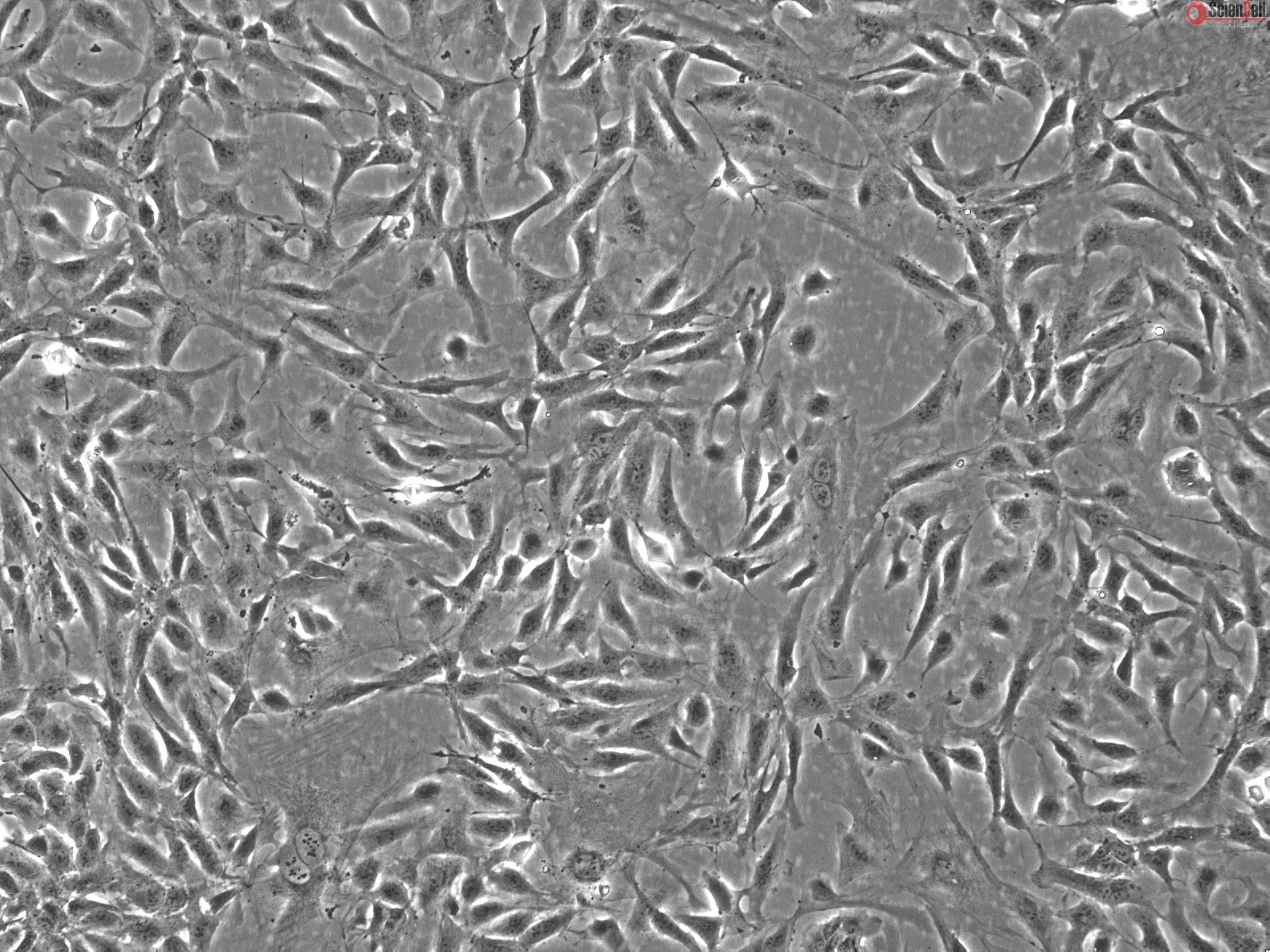 Rabbit Renal Mesangial Cells