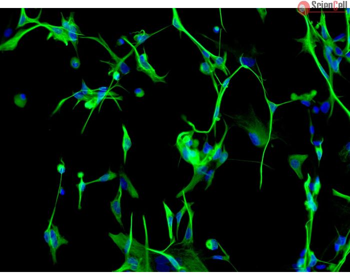 rat astrocytes