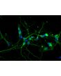NEW! Rat Neurons-midbrain