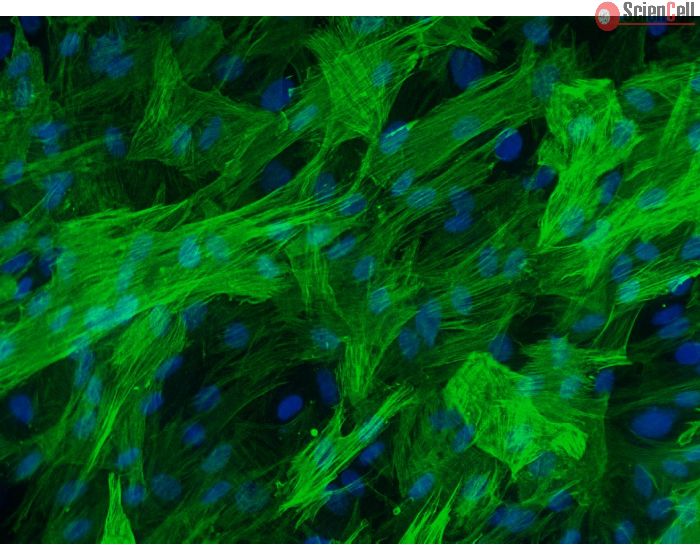 Rat Pulmonary Artery Smooth Muscle Cells