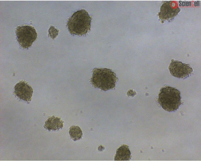 Ready-to-use 3D Human Bronchial Fibroblast Spheroids