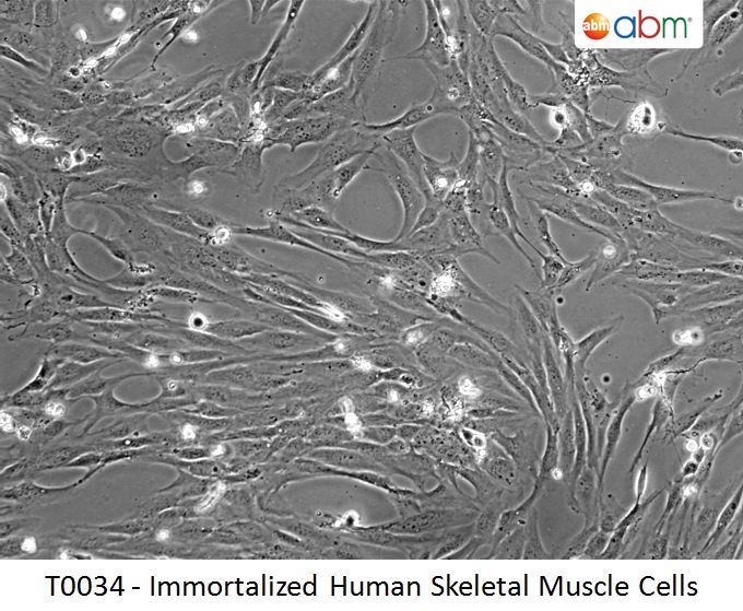 Immortalized Human Skeletal Muscle Cells