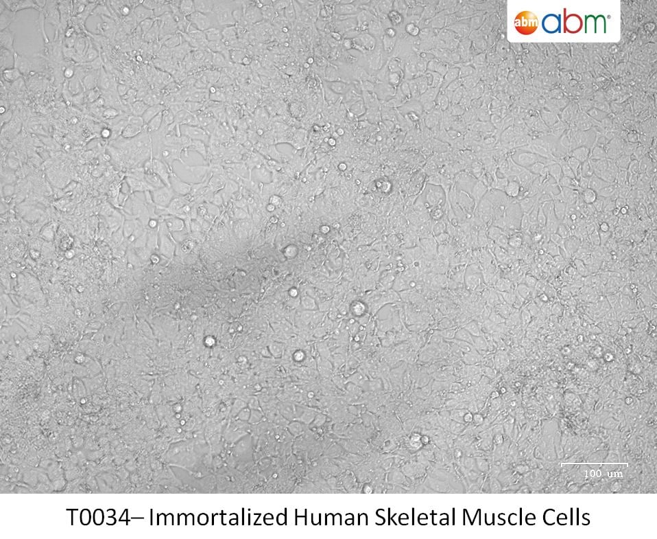Immortalized Human Skeletal Muscle Cells