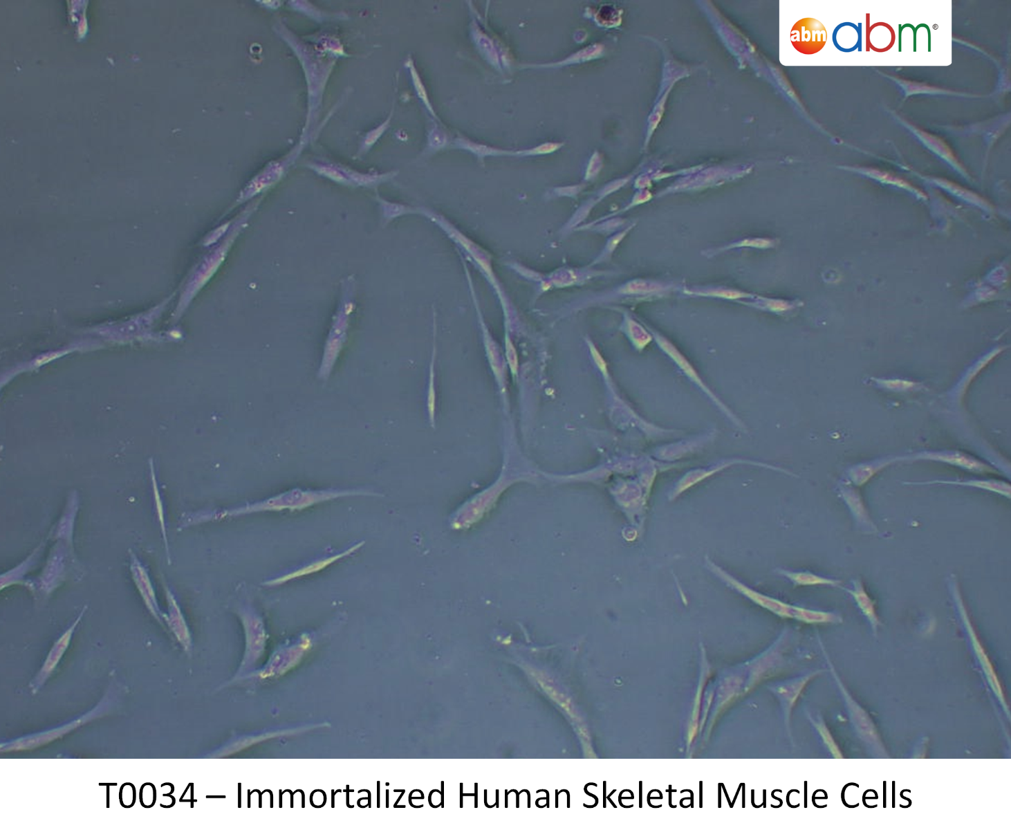 Immortalized Human Skeletal Muscle Cells